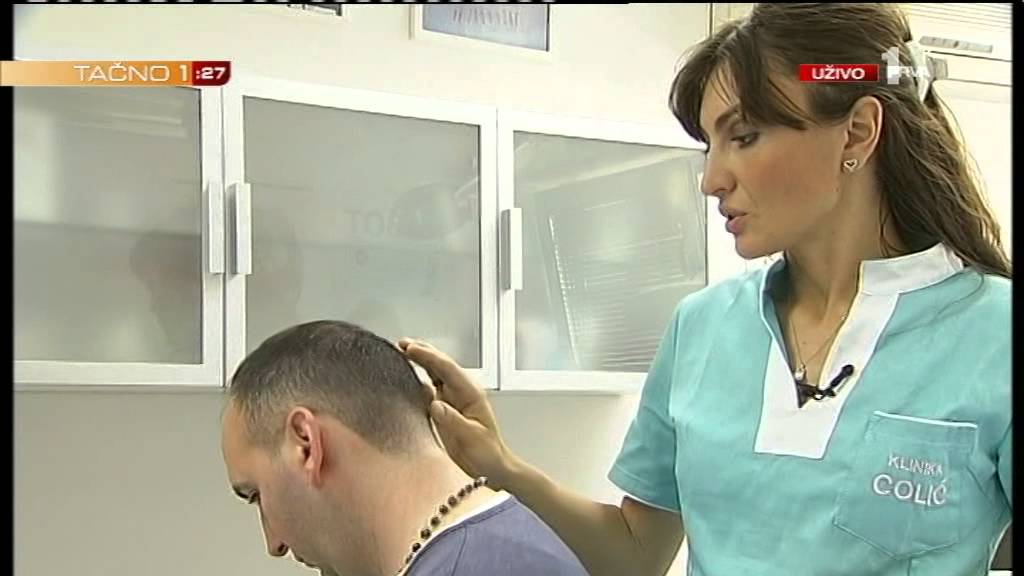 Transplantacija kose Dr Colic Bolnica www.haircenter.rs TV PRVA - YouTube