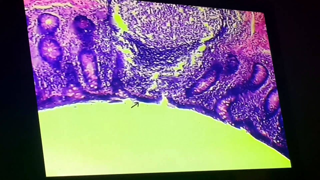 Appendix. .. large intestine - YouTube