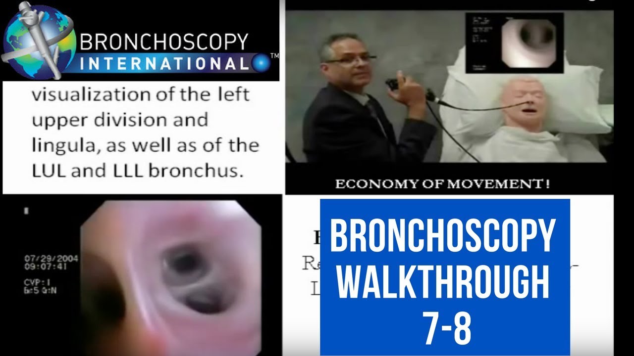 Bronchoscopy Step by Step Walkthrough 7-8 - YouTube