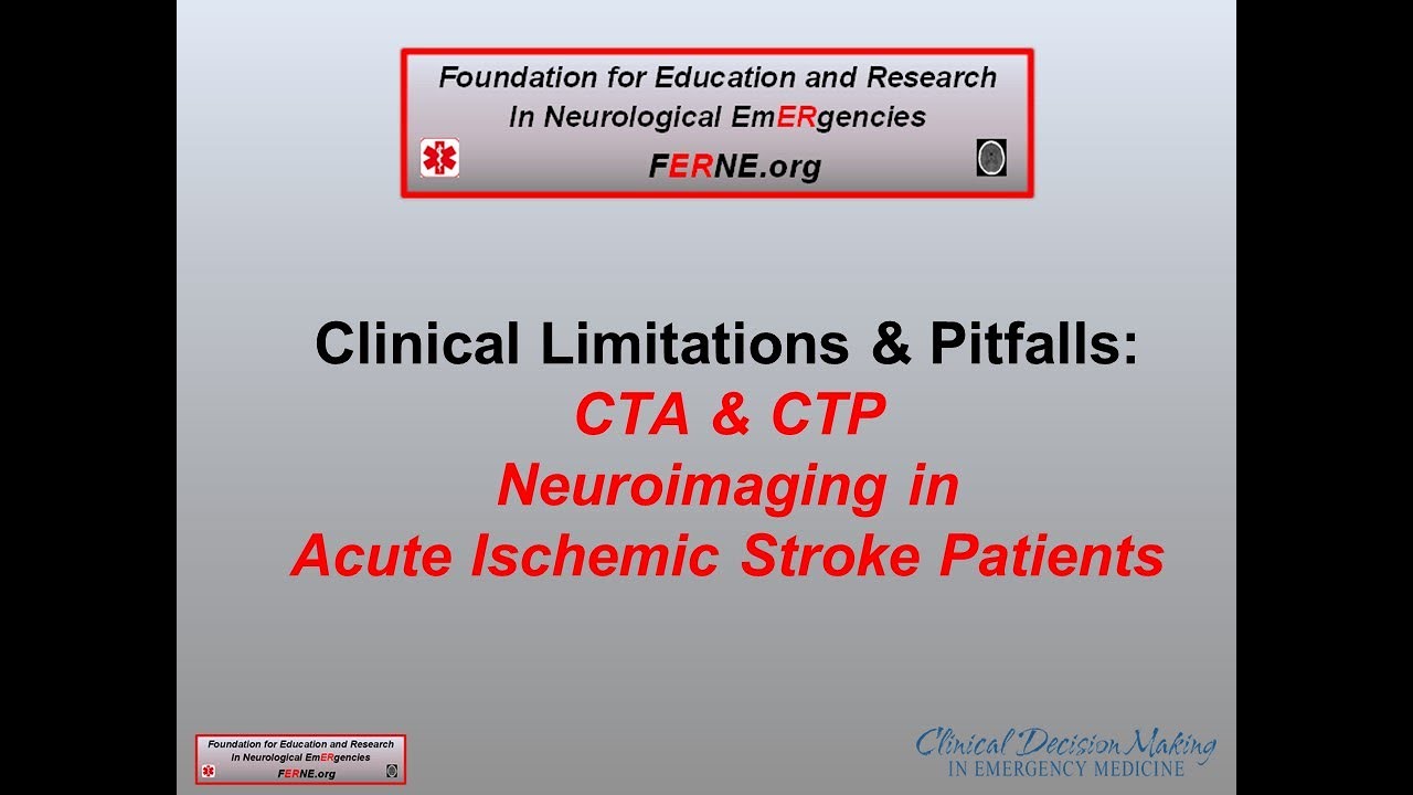 Clinical Limitations & Pitfalls. CTA and CTP Neuroimaging in Acute ...