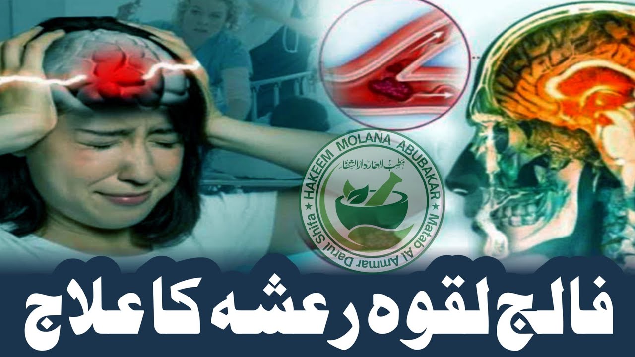 #Paralysis, Bell’s Palsy | Natural Cure for Falij, Laqwa & Raesha | # ...
