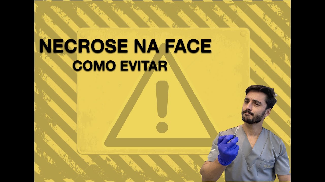 NECROSE COM PREENCHIMENTOS FACIAIS - COMO EVITAR! - YouTube