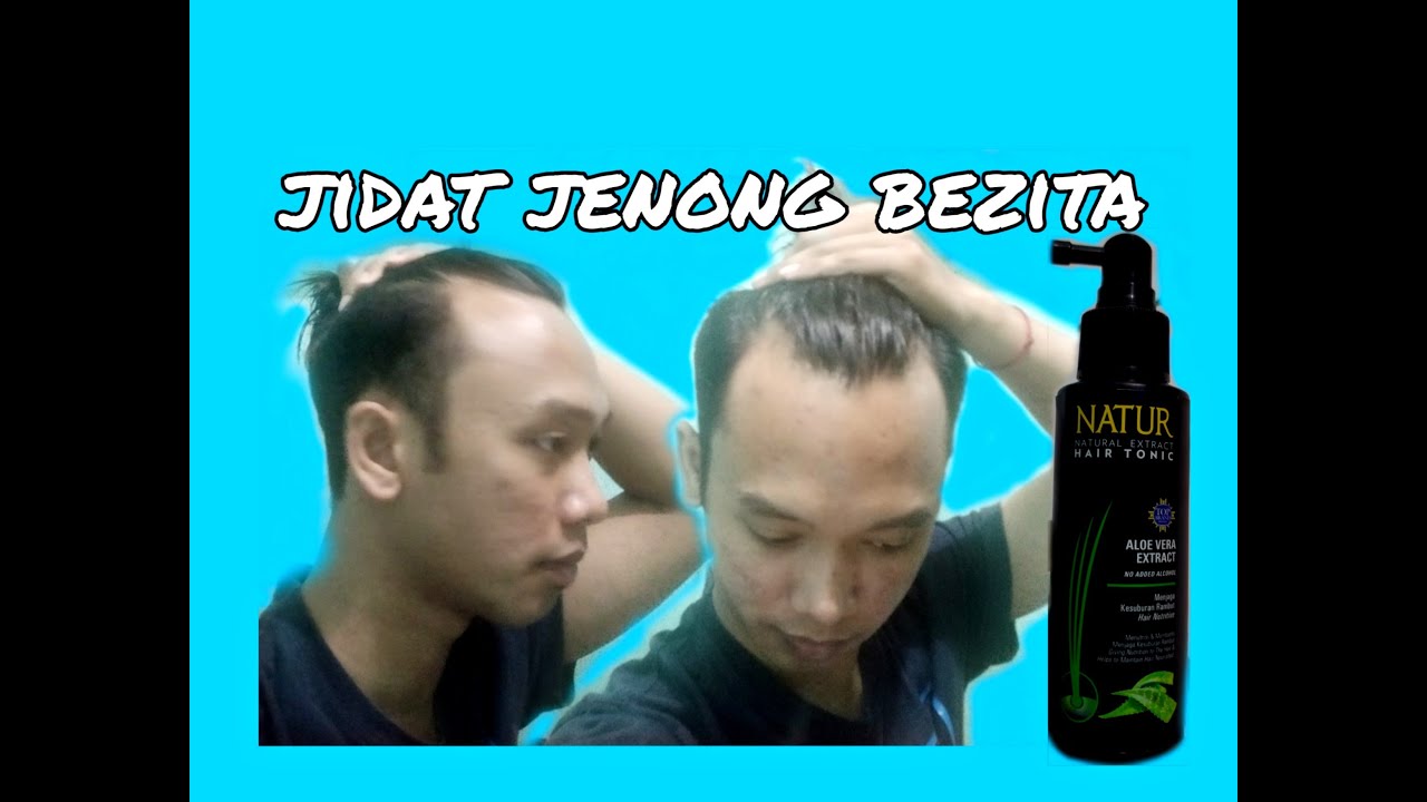 Hair tonic Penumbuh rambut dijidat jenong part1 - YouTube