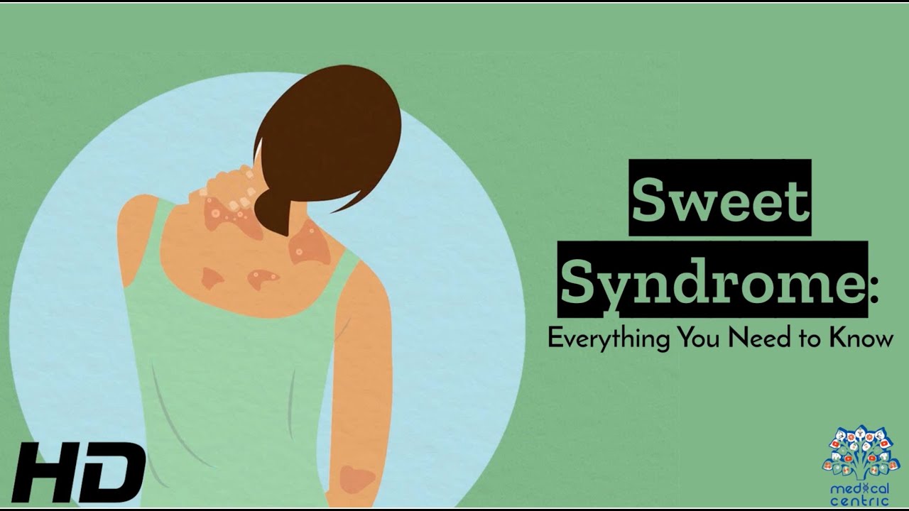 Sweet Syndrome Explained: Rare but Real - YouTube