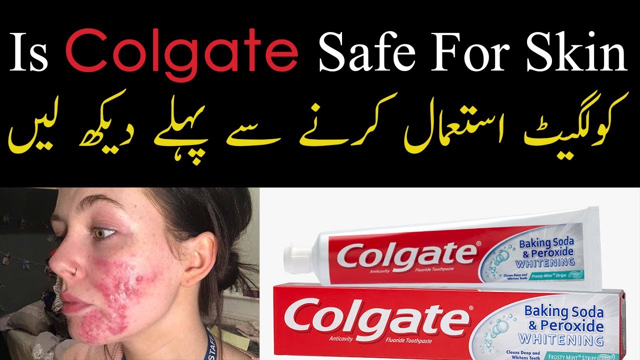 Colgate For Skin Whitneing | is Colgate Safe For Skin | Babar Ali - YouTube