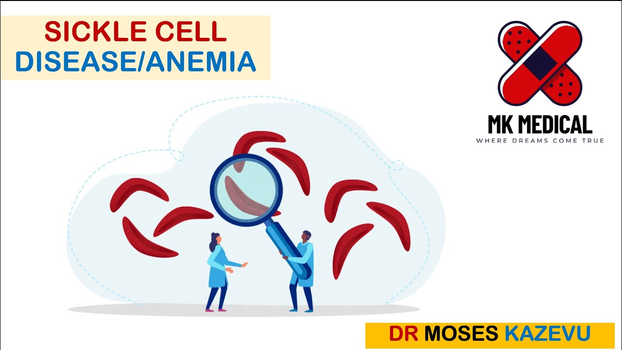 Sickle cell Anemia || SCA || SCD - YouTube