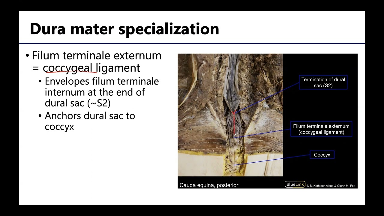 Cauda Equina Cadaver