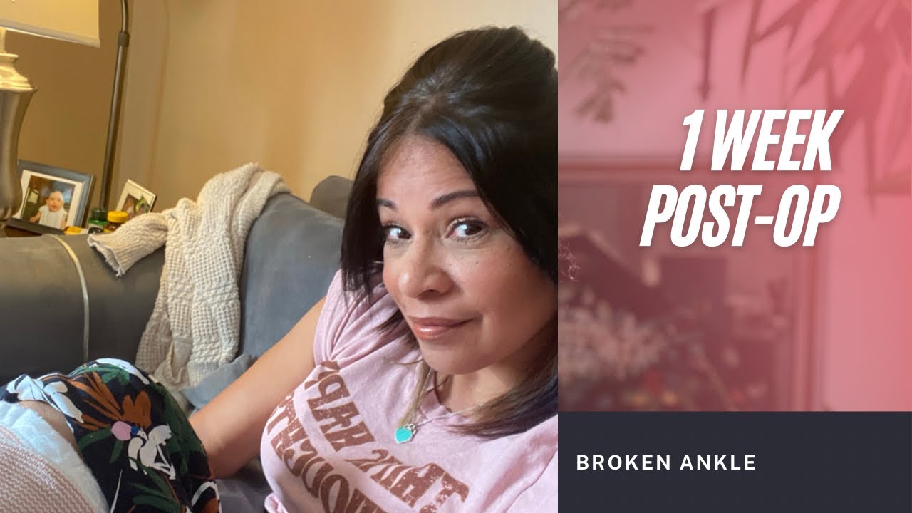 1 week post op/ ankle surgery - YouTube