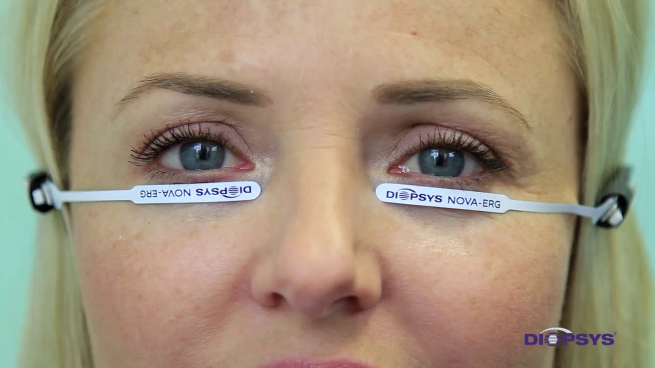 Diopsys® ffERG Vision Testing Training Video - YouTube