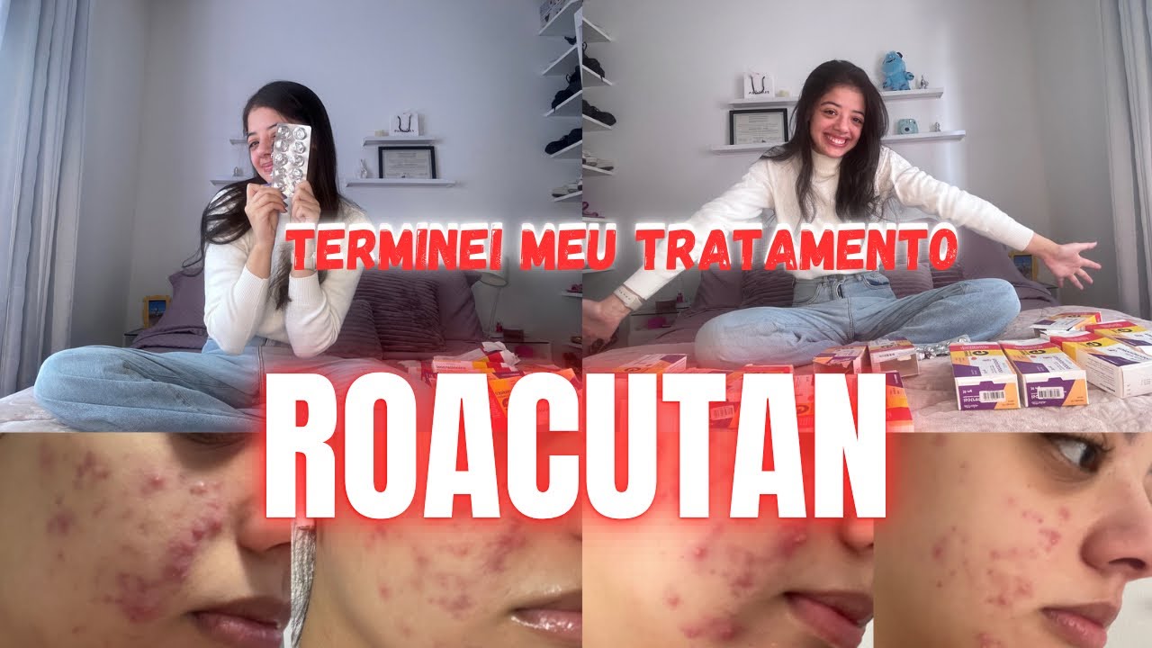 TERMINEI MEU TRATAMENTO COM ROACUTAN! Sintomas, produtos e fotos do ...