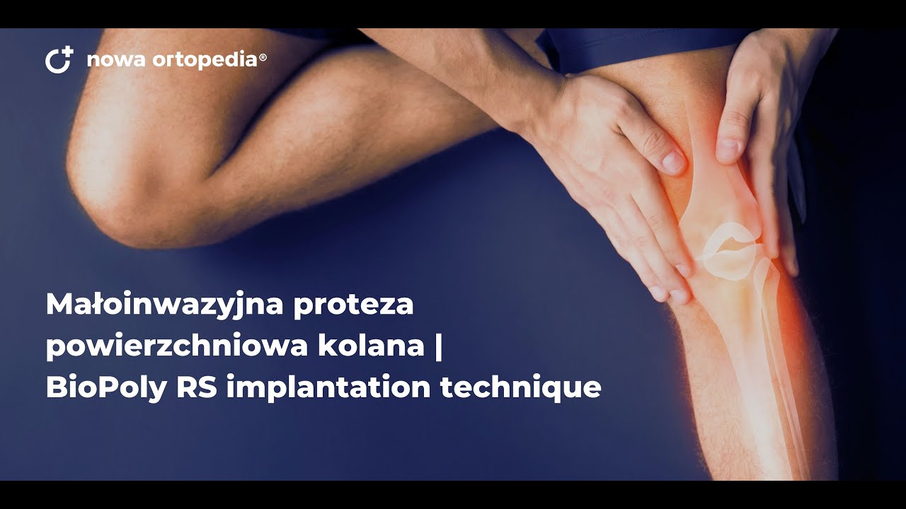 Małoinwazyjna proteza powierzchniowa kolana | BioPoly RS implantation ...