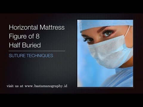 SUTURE TECHNIQUES | #4 from 8 | Horizontal Mattress, Figure of Eight ...
