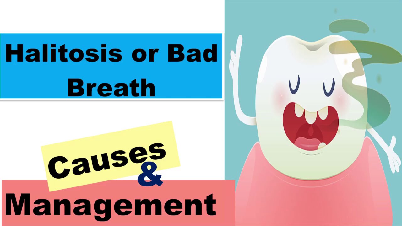 Halitosis/ Bad Breath CAUSES AND MANAGEMENT - YouTube