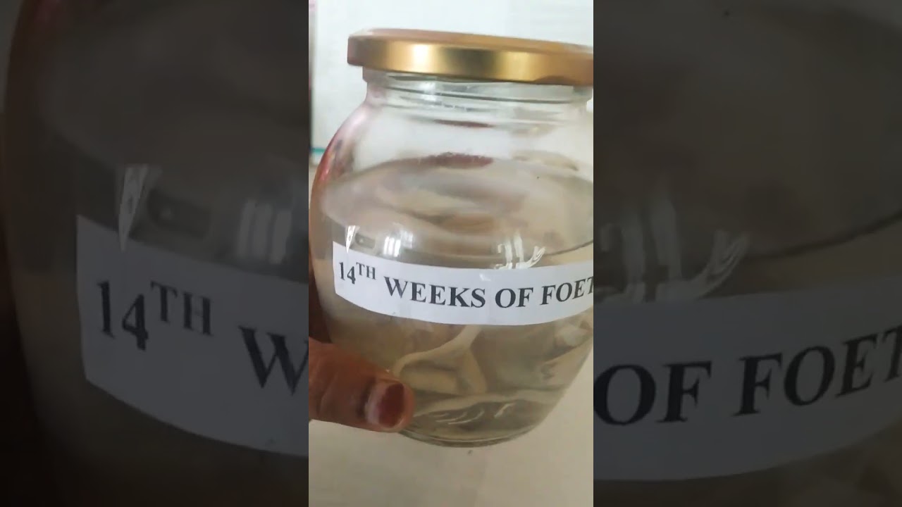 14th weeks of fetus@DIYAS NURSING CORNER IDEAS AND TIPS - YouTube