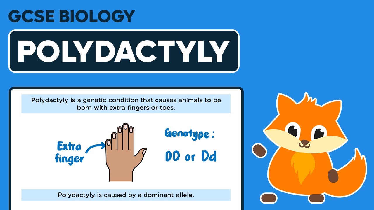 Inherited Disorders: Polydactyly - GCSE Biology - YouTube