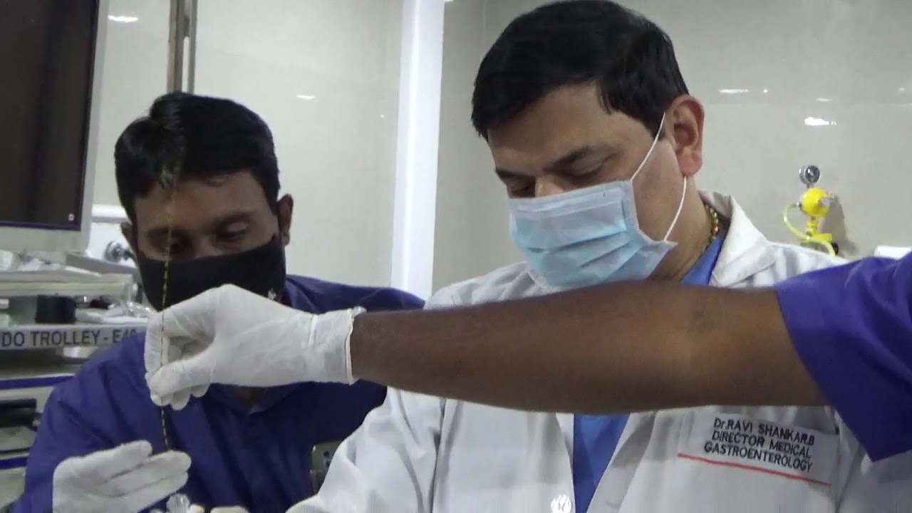 Demonstration of Spyglass Cholangioscopy - YouTube