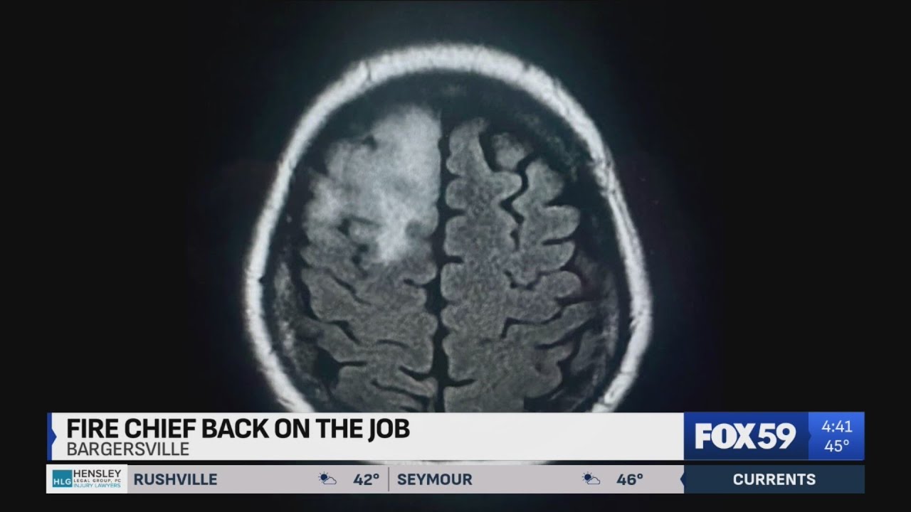 Fire chief back on the job after brain tumor removed - YouTube