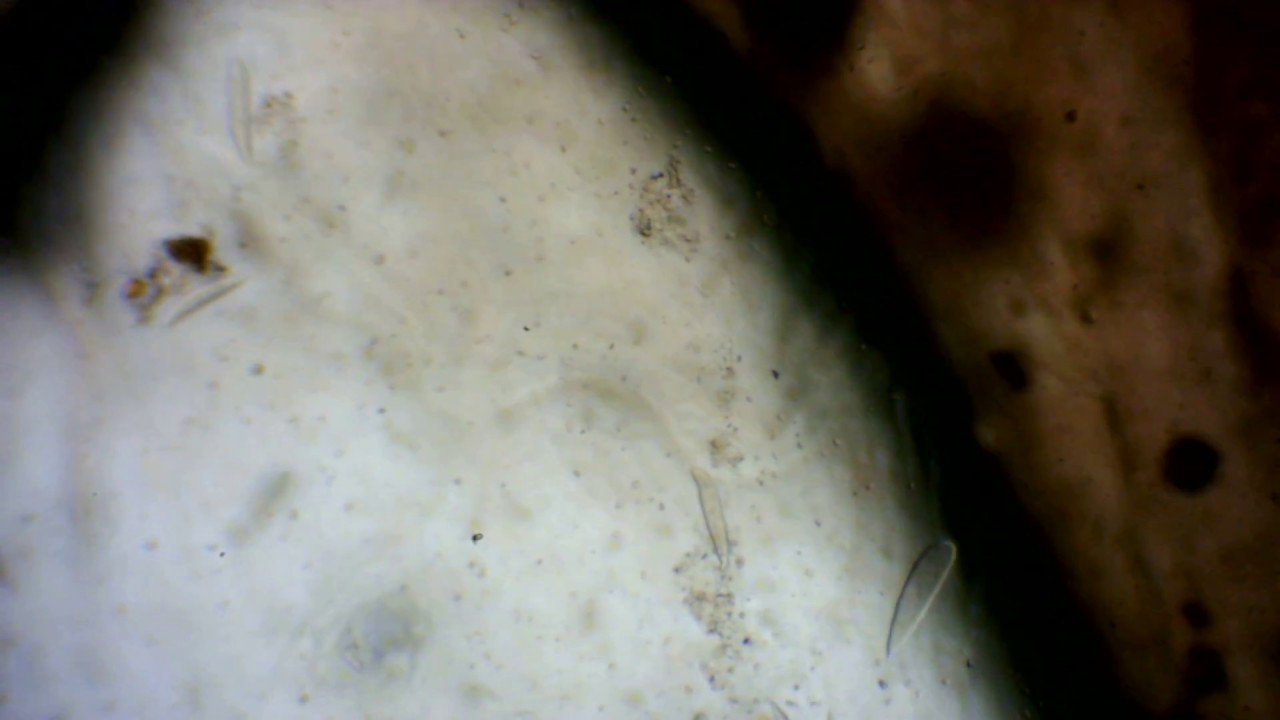 Protoopalina - YouTube