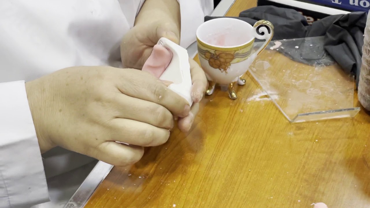 Prosthodontics mandible cast - YouTube