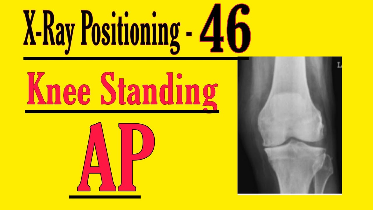 KNEE STANDING AP POSITIONING HINDI | X RAY POSITIONING FOR ...