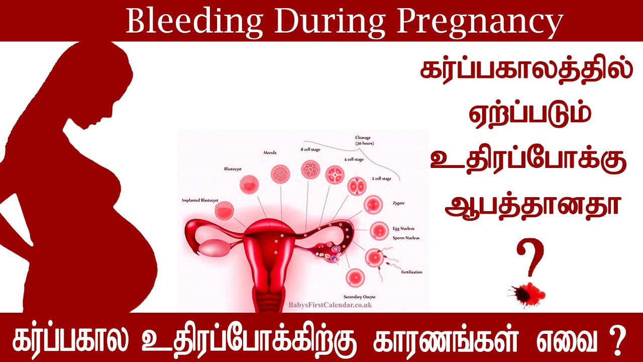 Early Miscarriage Bleeding