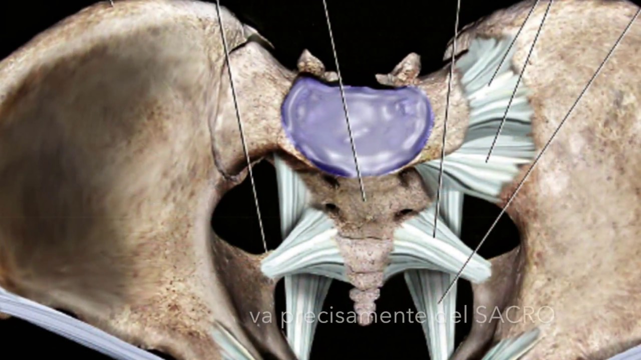 Cirugía Para Prolapso De Cúpula Vaginal Con Dispositivo Uphold Youtube
