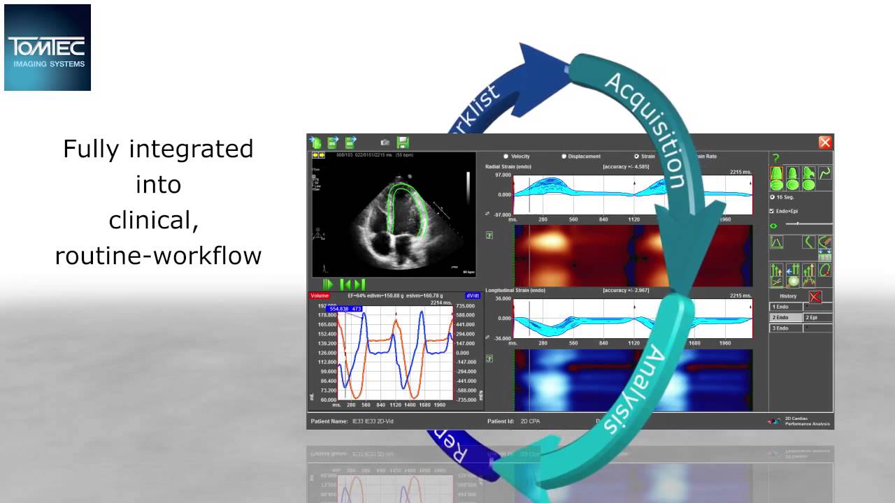 2D Cardiac Performance Analysis - YouTube