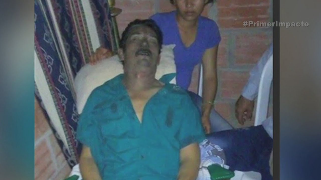 Hombre Desmoronándose Muerte