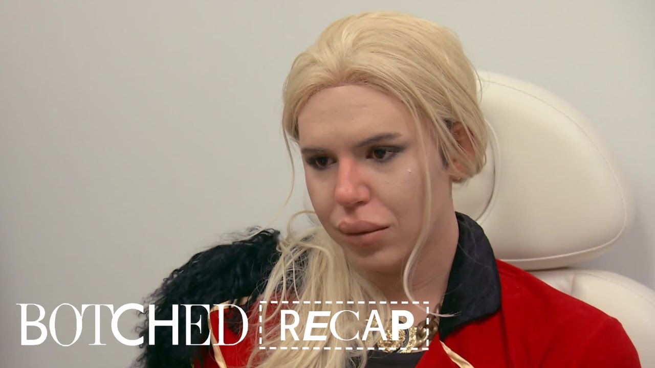 "Botched" Recap: Season 4, Episode 17 | E! - YouTube