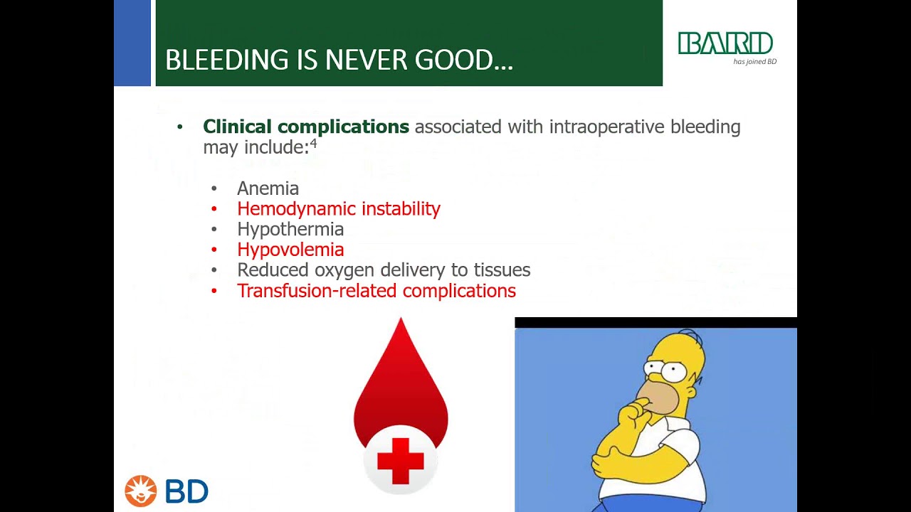 Minimizing Intra-Operative Bleeding in Orthopedics: ARISTA™ - YouTube