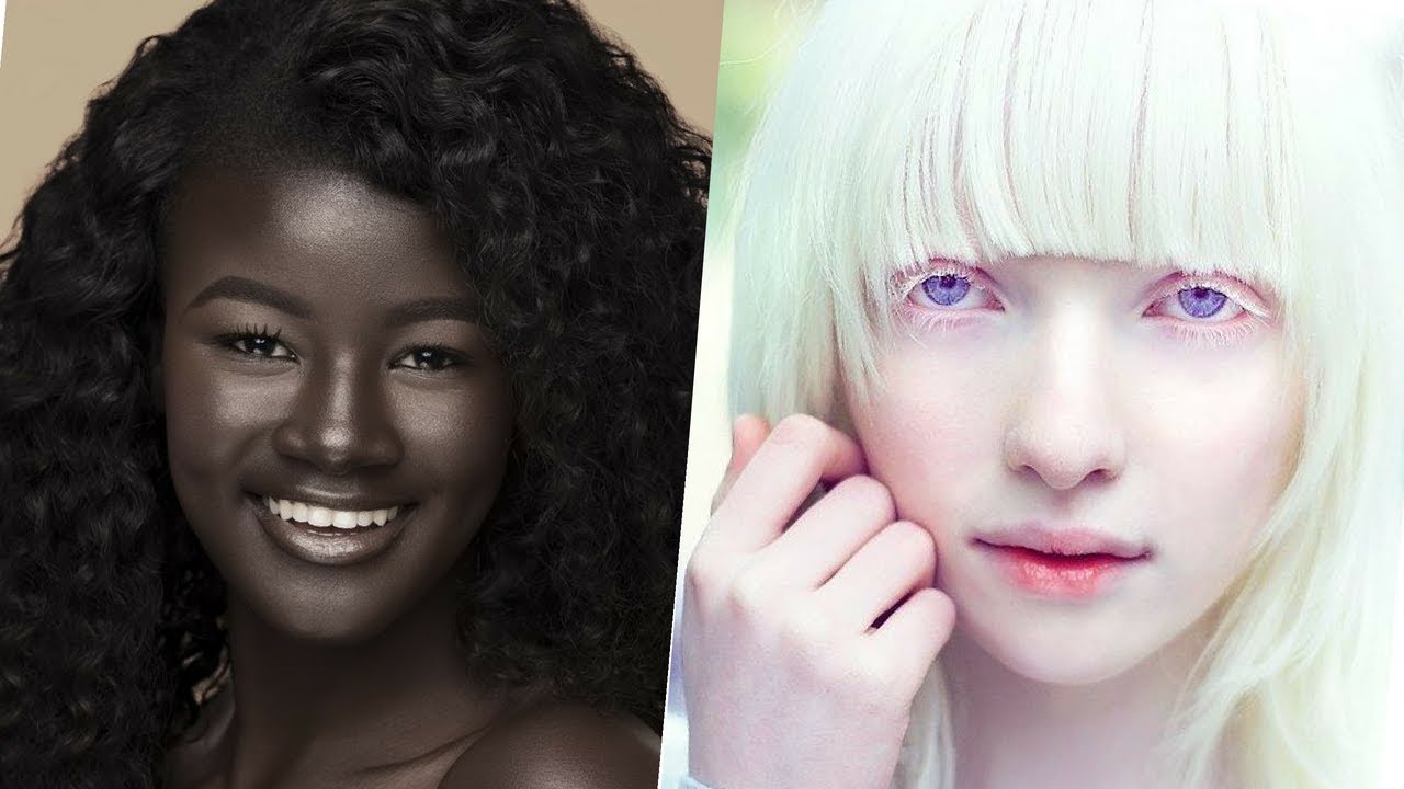 7 Gorgeous People with Unique Skin Color 2018 - YouTube