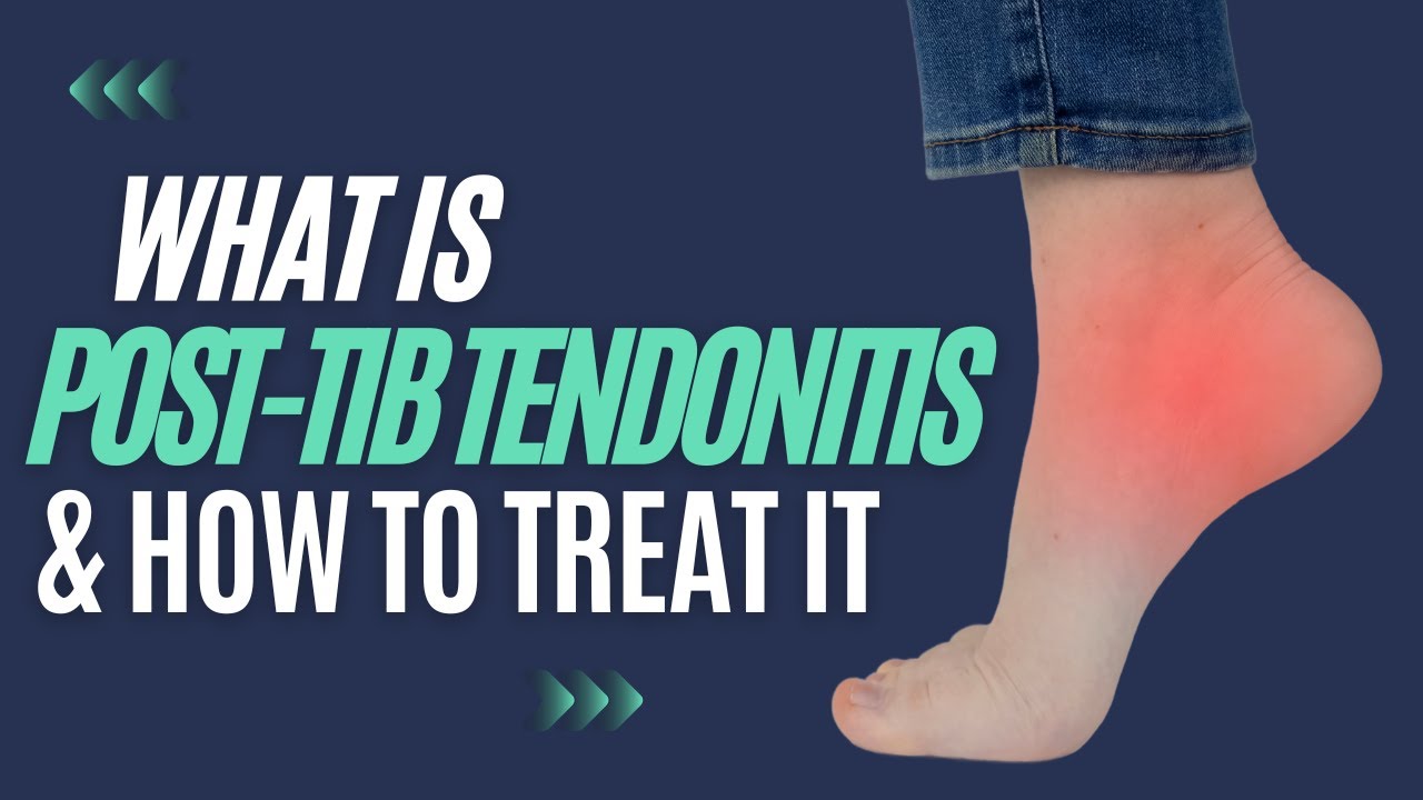 Posterior Tibial Tendonitis - What is it and how do you treat it? - YouTube