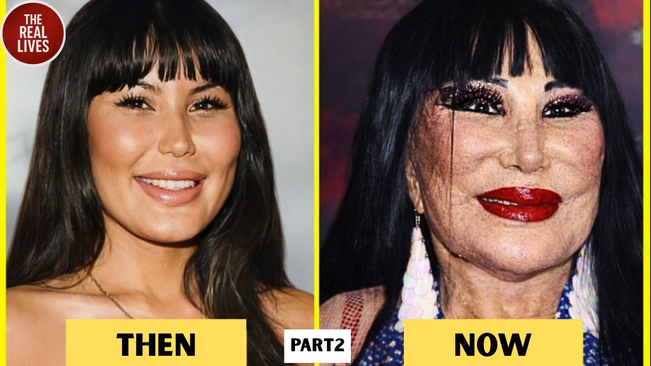 When Beauty Went Too Far: Hollywood’s Most Shocking Transformations ...