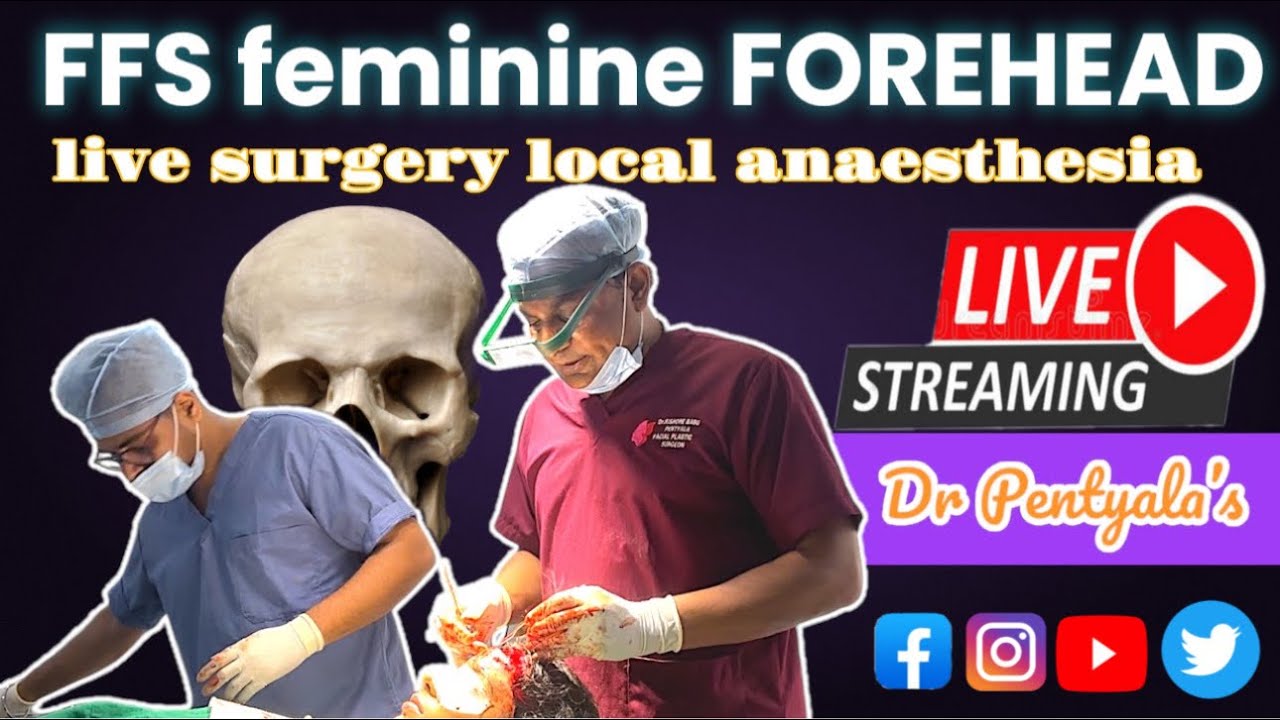FFS Forehead Feminine Surgery amazing Results in India #drpentyalas # ...