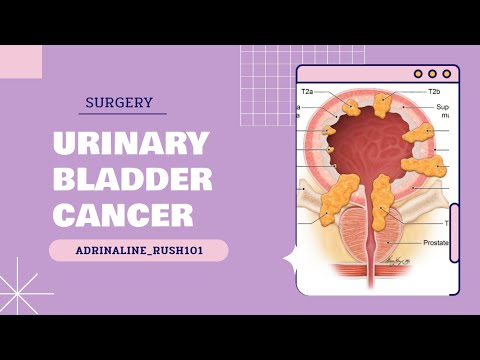 Urinary Bladder Carcinoma | TNM staging | surgery - YouTube