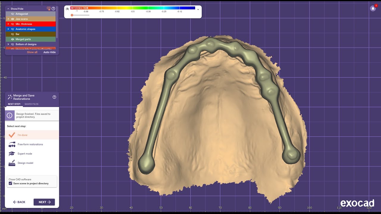 How to design titanium bar for single piece basal implant in exocad ...