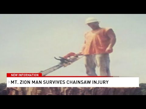 Man miraculously survives freak accident with chainsaw - YouTube