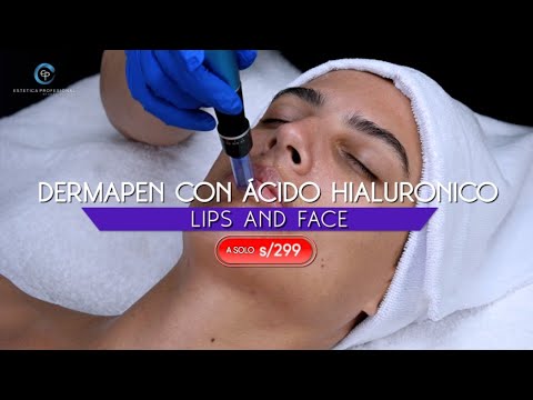 DERMAPEN + ÁCIDO HIALURÓNICO - LIPS AN FACE - YouTube