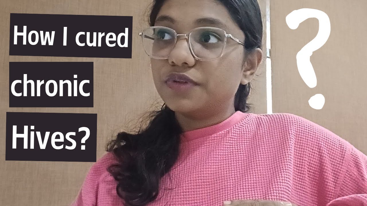 How I cured my chronic Hives? Autoimmune or leaky gut || Itching, red bumps, swelling - YouTube