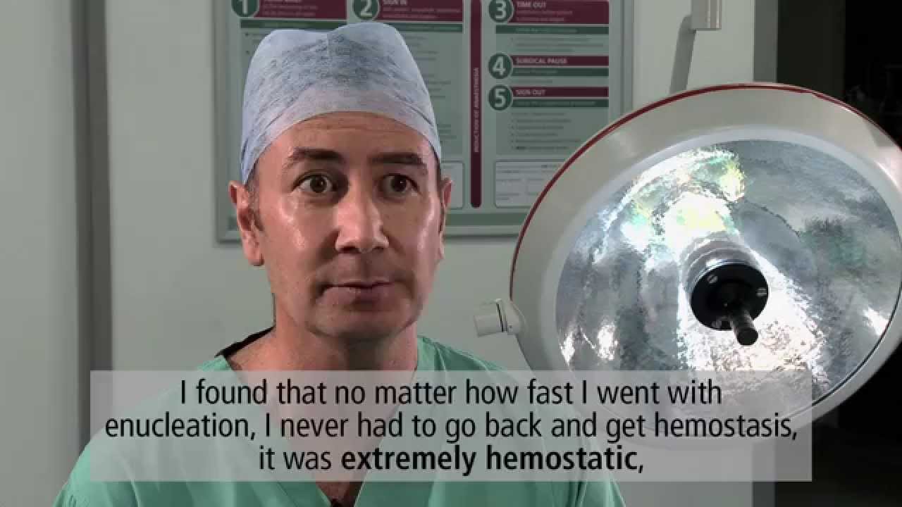 HoLEP with Lumenis Pulse 120H Holmium Laser, Dr. Aho - YouTube