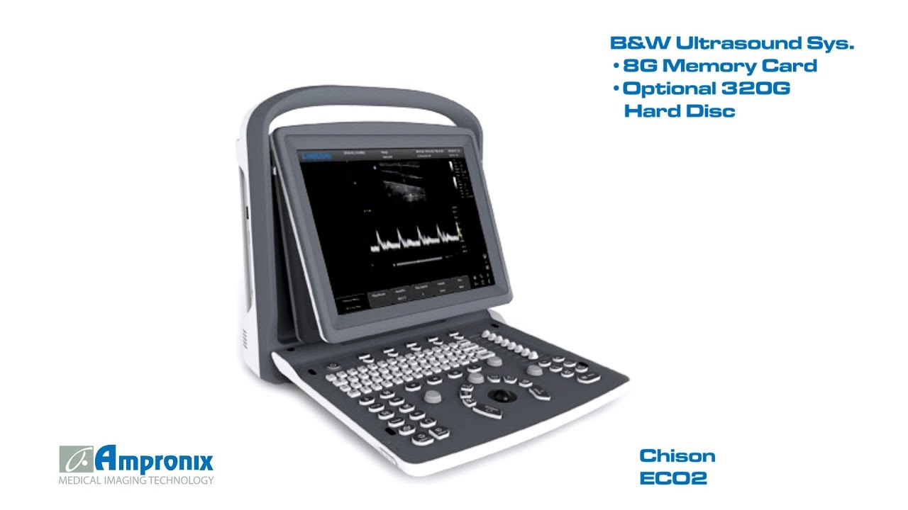 Chison ECO2 Ultrasound System Sales | Service | Repair | Exchange ...