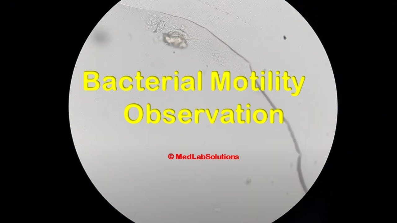 Motile Bacteria in Hanging Drop Preparation - YouTube