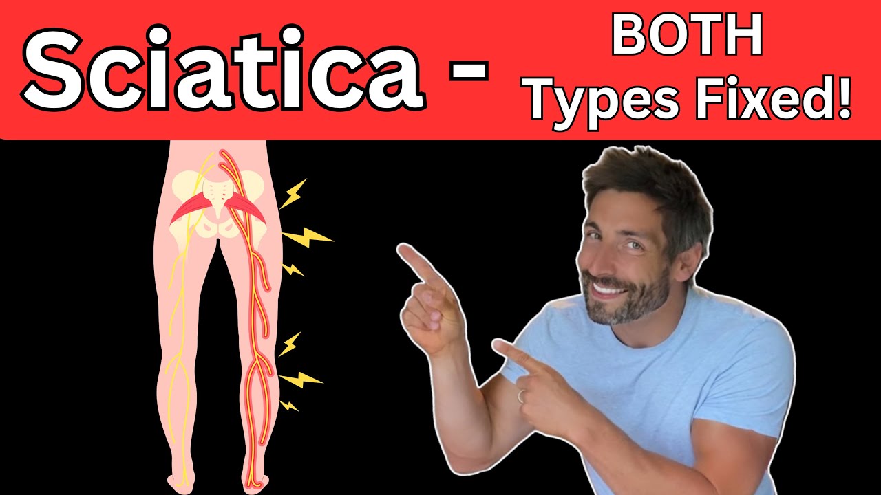 How To Fix Sciatica - Immediate Relief! - YouTube