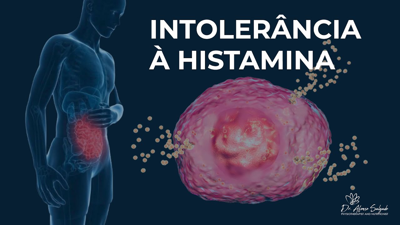 Live IntolerÂncia À Histamina Youtube