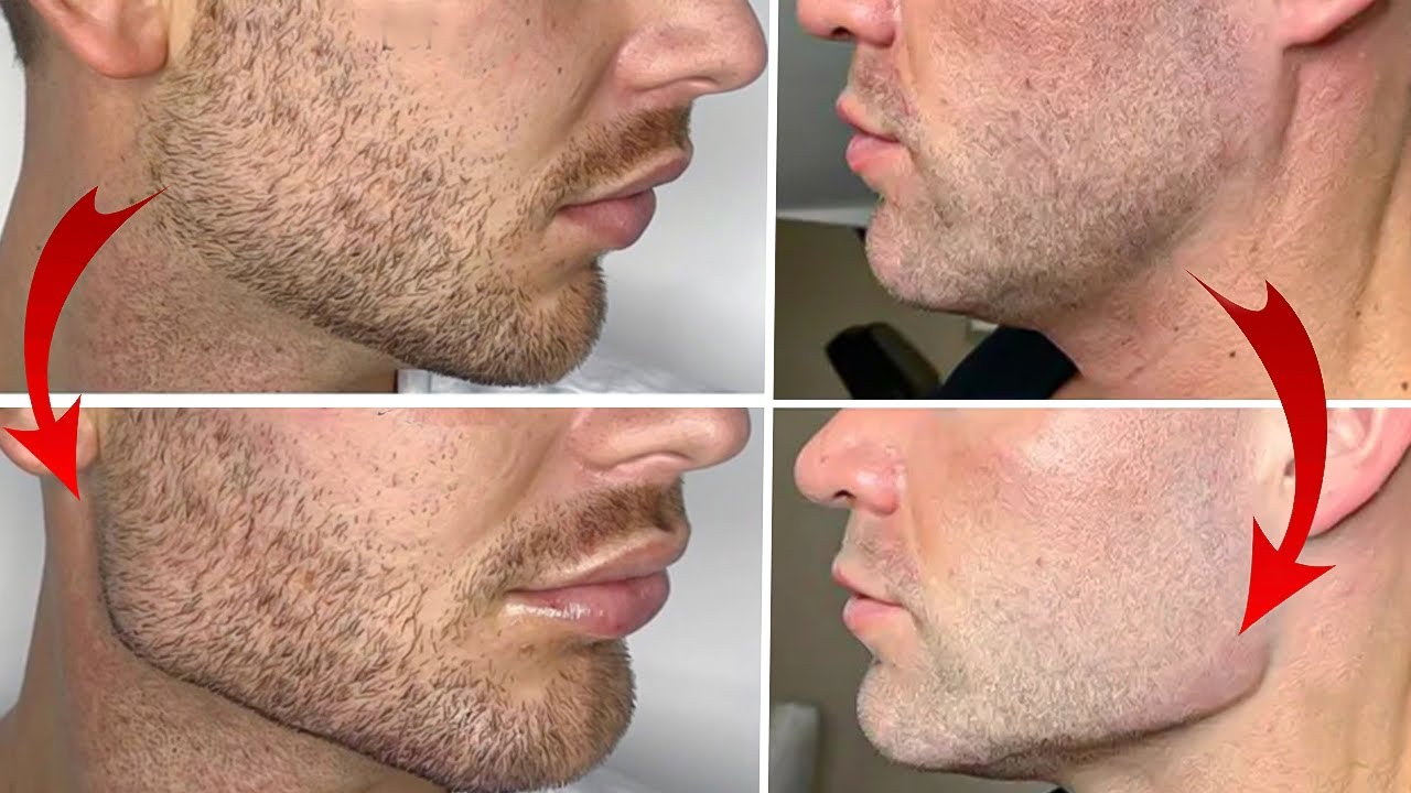 Get Jawline in Less than 4 min - Without equipment - YouTube