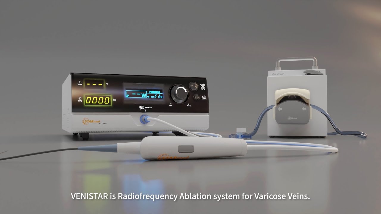 Varicose Vein RFA procedure 3D video - YouTube