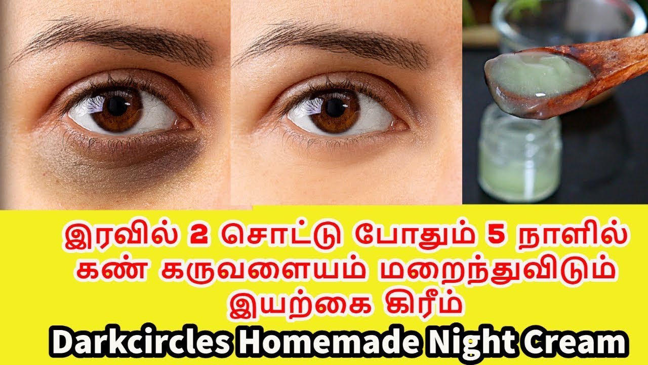 Remove Dark Circles Permanently in 1 Week (Best Home Remedy) # ...