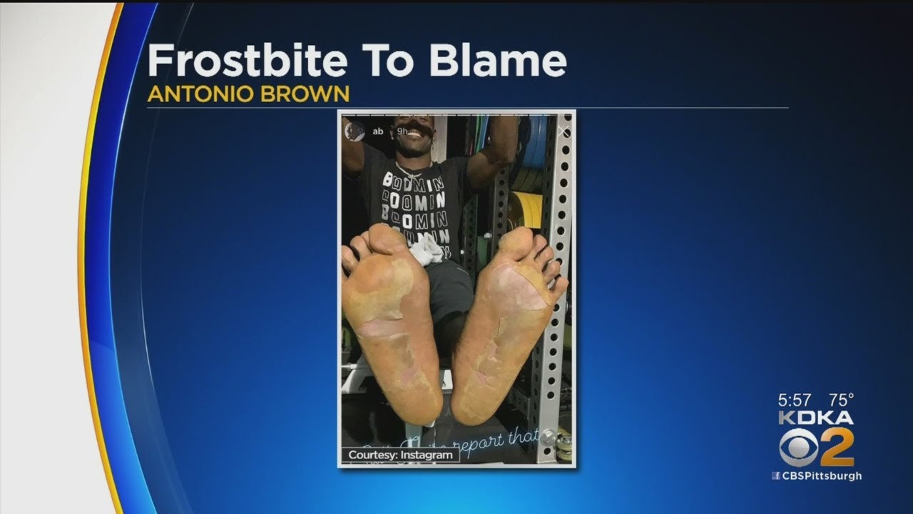 Frozen Toes Dealing With Big Toe Numbness: Tips For Relief