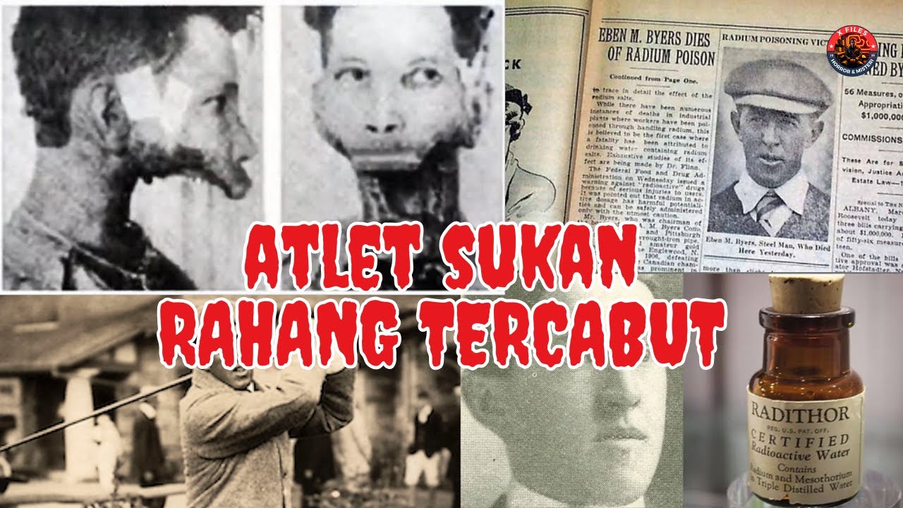 Kisah Pelik Eben Byers, Minum Radium Sehingga Rahang Mulutnya Tercabut ...