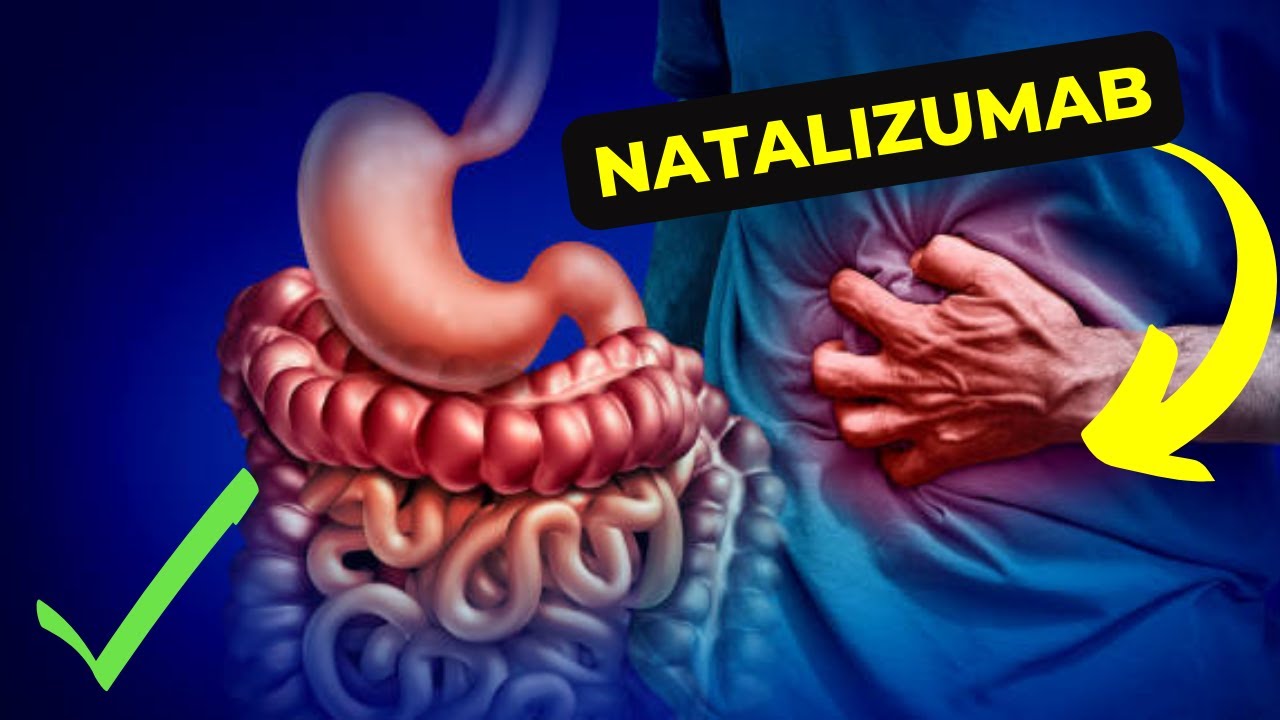 Natalizumab: Unveiling Its Versatile Uses and Unraveling the Hidden ...